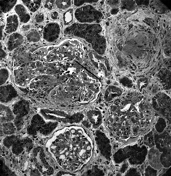 Electron Microscopy Services - Jason Reidy - Glomerulus